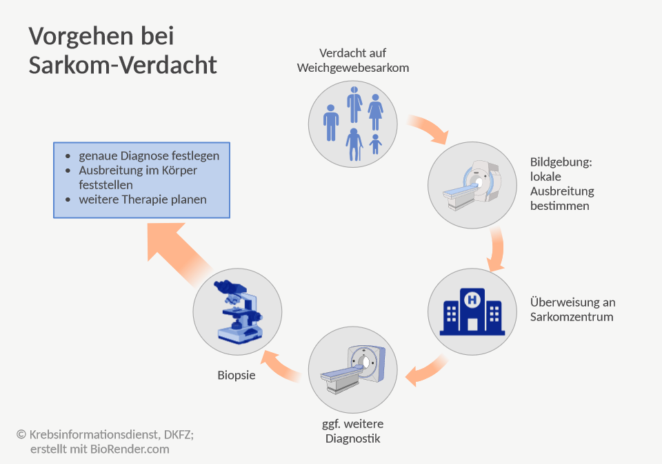 Diagnostik bei Weichteilsarkomen | DKFZ - Krebsinformationsdienst