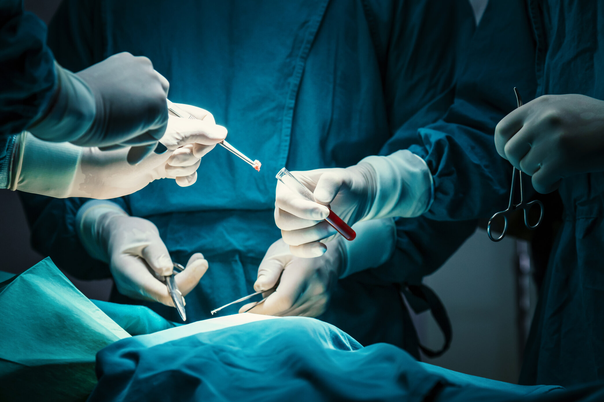 Biopsie: So werden Gewebeproben oder Zellen entnommen | DKFZ ...