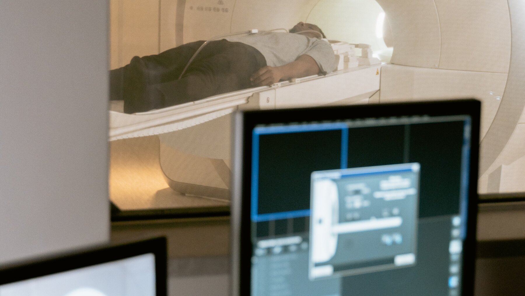 Weichteilsarkome: Prognose, Einteilung, Häufigkeit | DKFZ ...