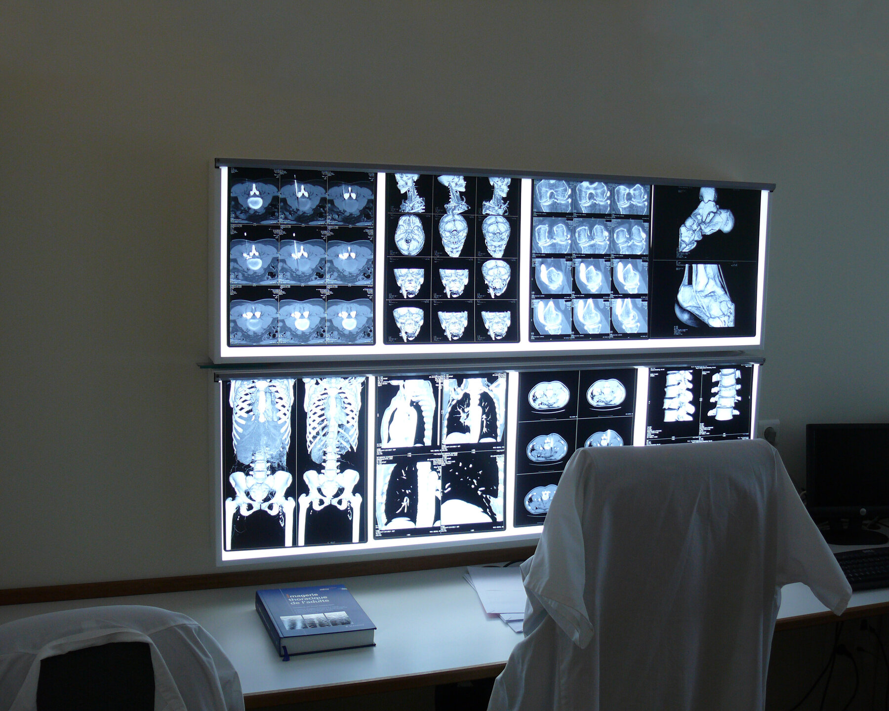 Computertomographie: Schnittbilder des Körperinneren | DKFZ ...